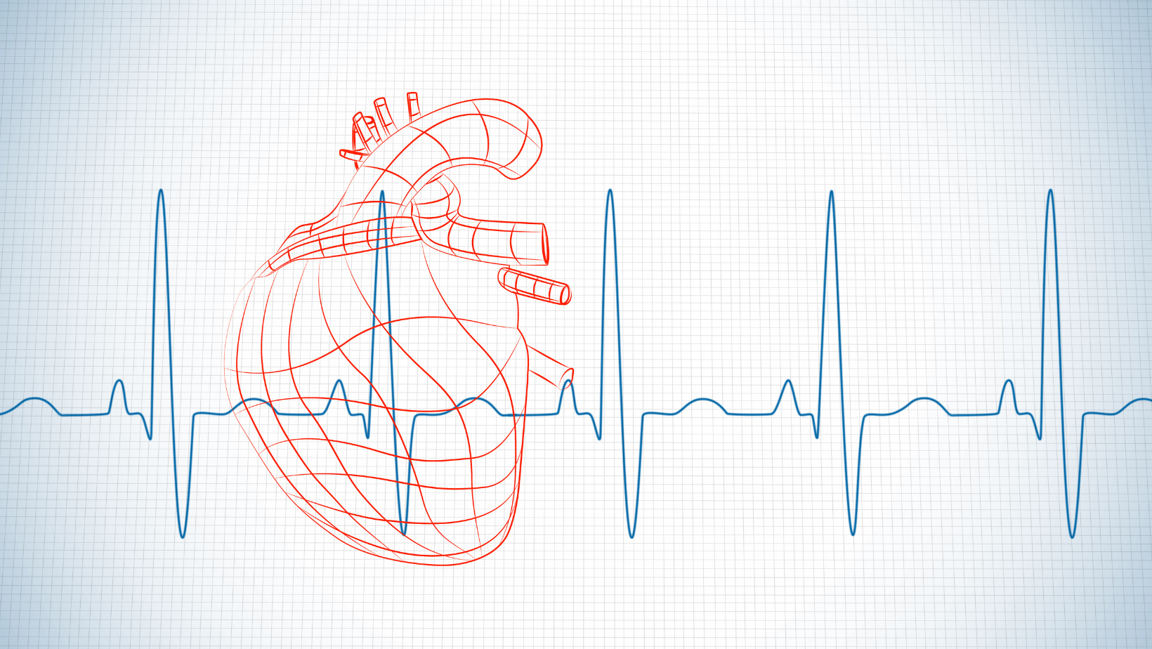 Condition Spotlight: Postural Orthostatic Tachycardia Syndrome (POTS ...