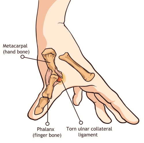 Blog 1 — Island Hand Therapy Clinic