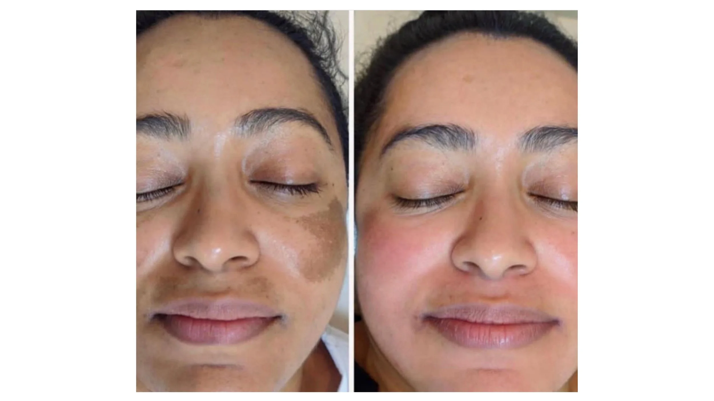 ROSE DE MER- Peeling Profesional 100% natural — Centro Estético ...