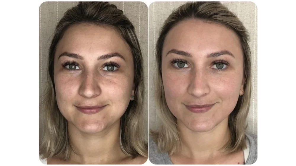 ROSE DE MER- Peeling Profesional 100% natural — Centro Estético ...