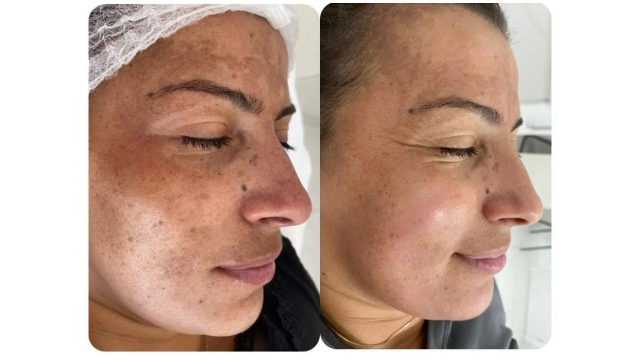 ROSE DE MER- Peeling Profesional 100% natural — Centro Estético ...