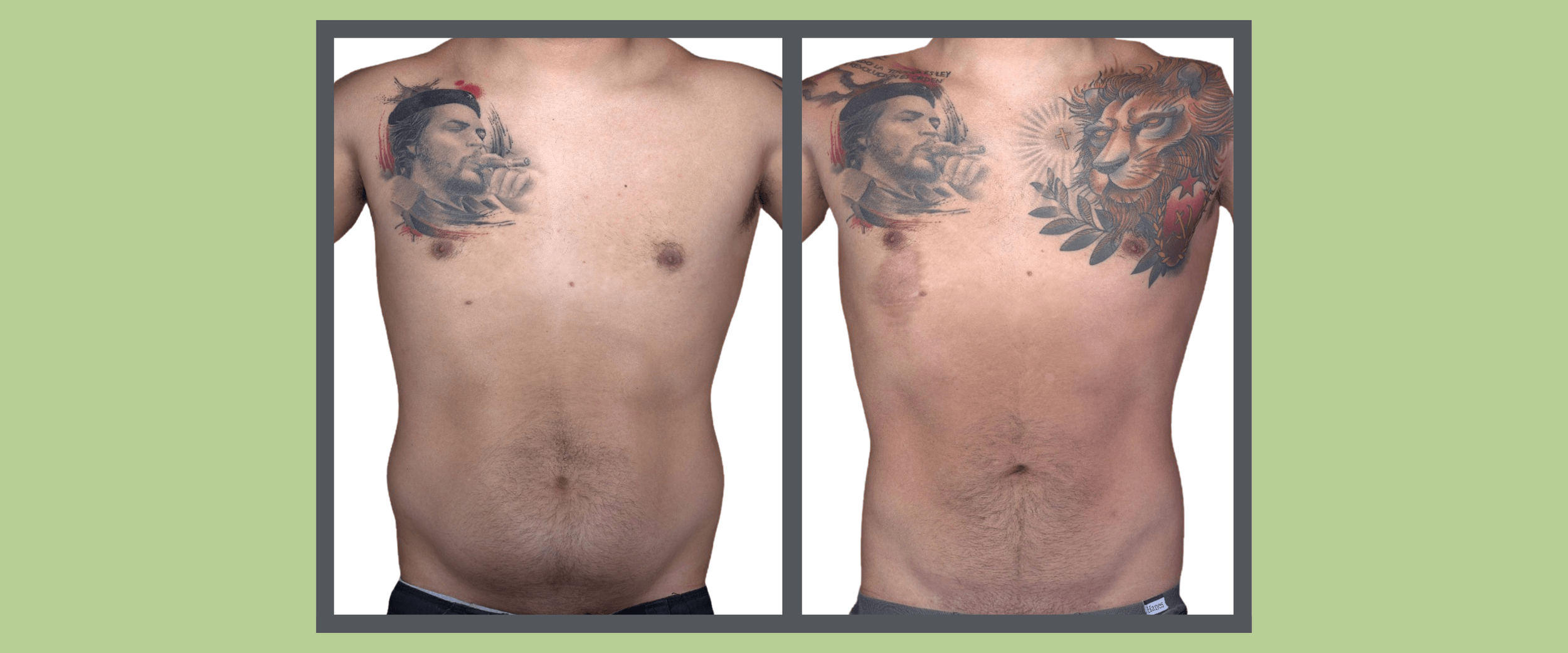 Cirujano Plástico en Puerto Rico - Dr. Claudio Corral