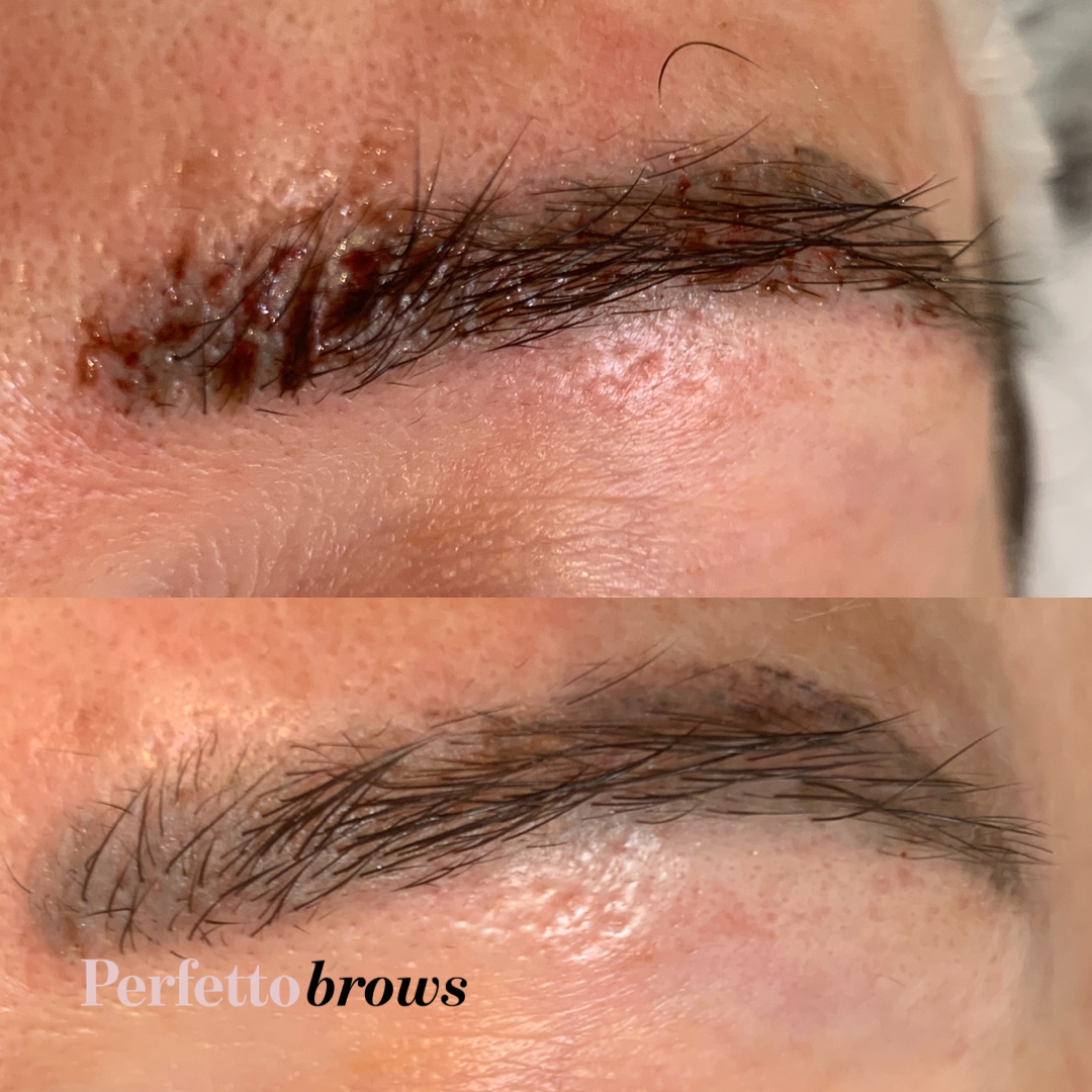 Sydney Brow Specialist | Home Perfetto brows