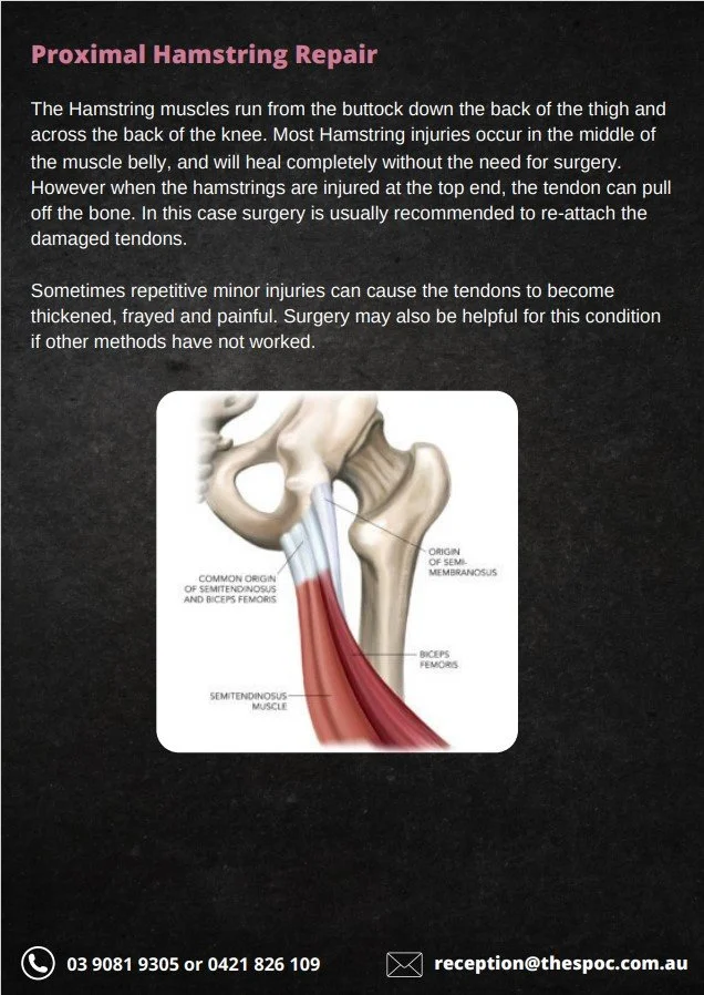 Proximal Hamstring — Sports Orthopaedic Centre