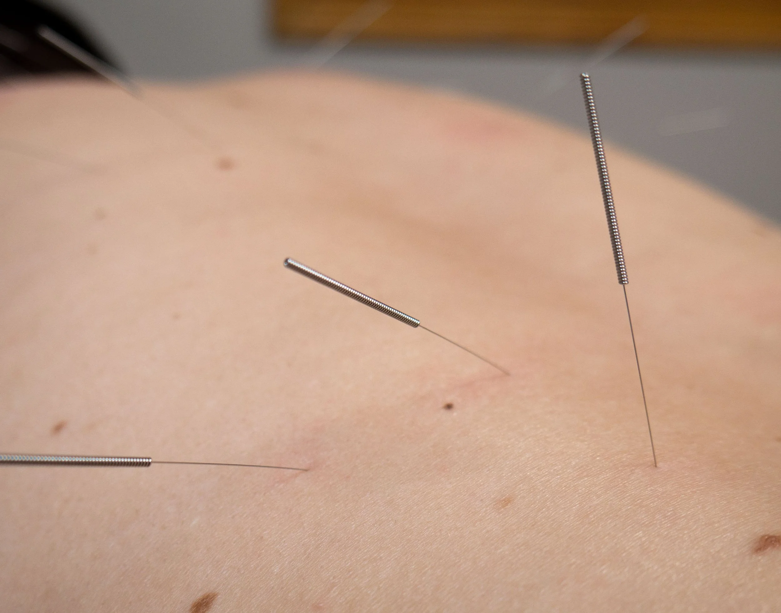 What Is Qi? Types of Qi According to Traditional Chinese Medicine — Nu ...