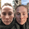 Zone Face Lift