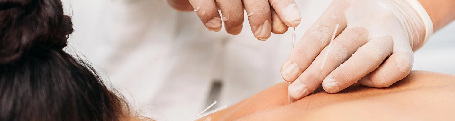 IMS / Dry Needling — Wetaskiwin Physical Therapy