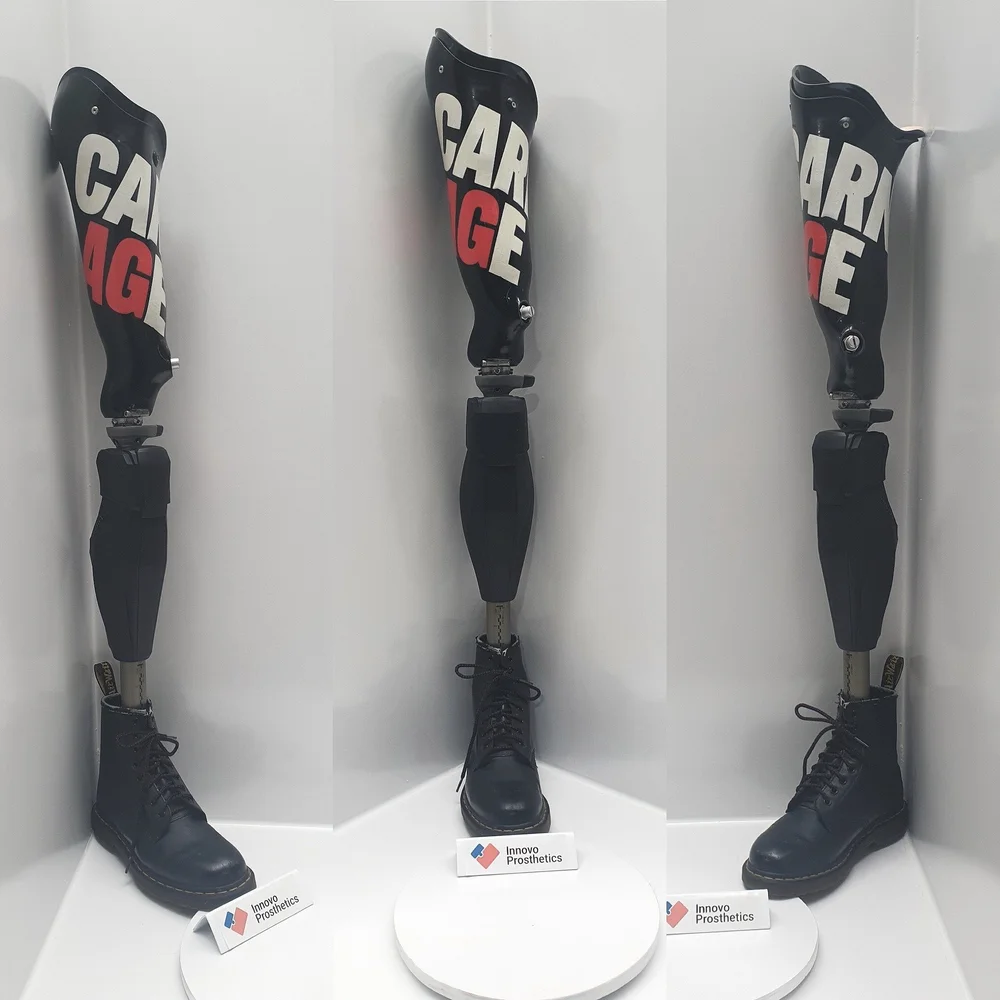 Lower Limb Prosthetics — Innovo Prosthetics