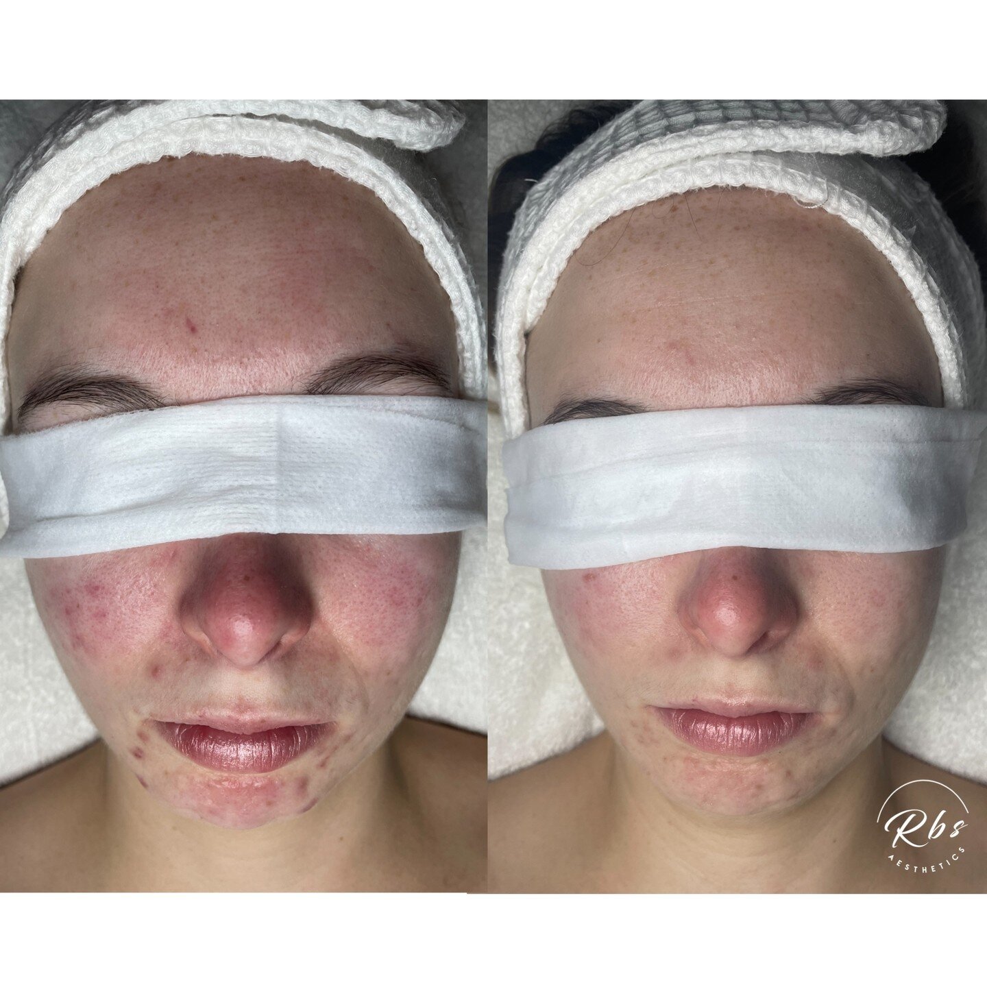 The Row Medi Spa & Wellness Lounge