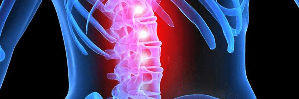 Spinal Cord Stimulation — Pain Management, Back Pain, Neck Pain