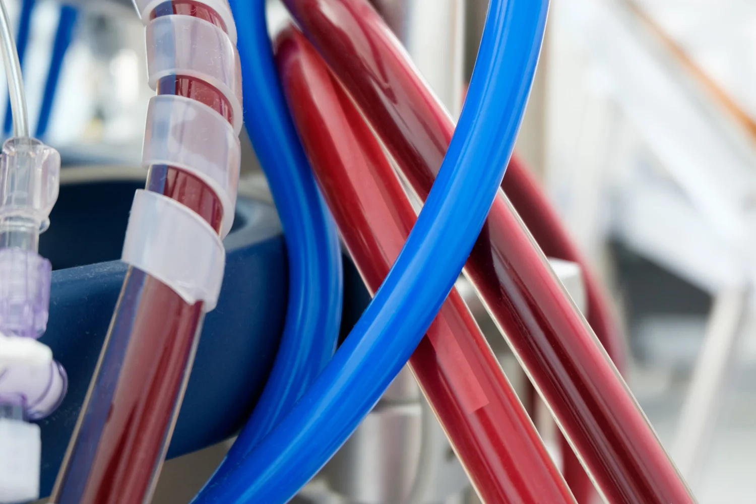 ECMO Specialist - ECMO Resource | A space for ECMO Specialists and their interdisciplinary ECMO ...