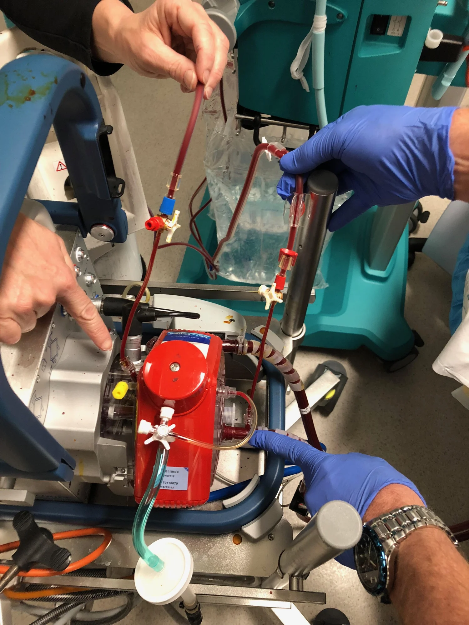 CRRT and ECLS - ECMO Resource | A space for ECMO Specialists and their ...