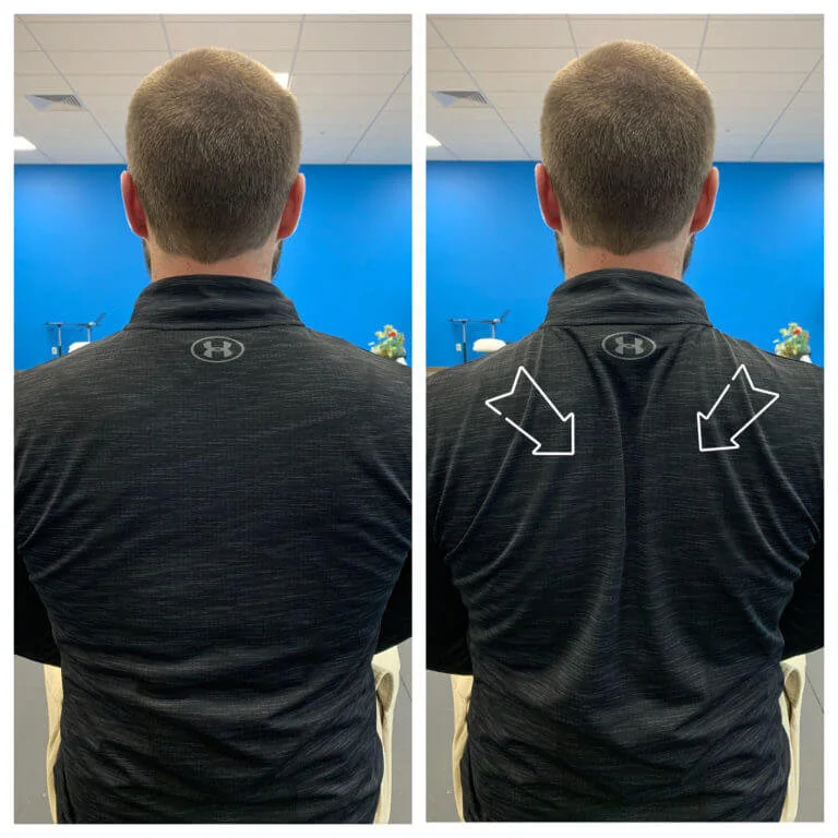 Overhead Athletes: Essential Exercises for Shoulder Stability and ...