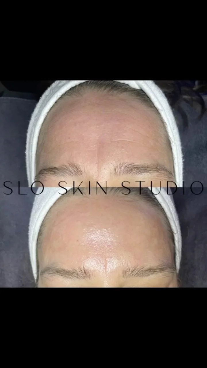 SLO Skin Studio