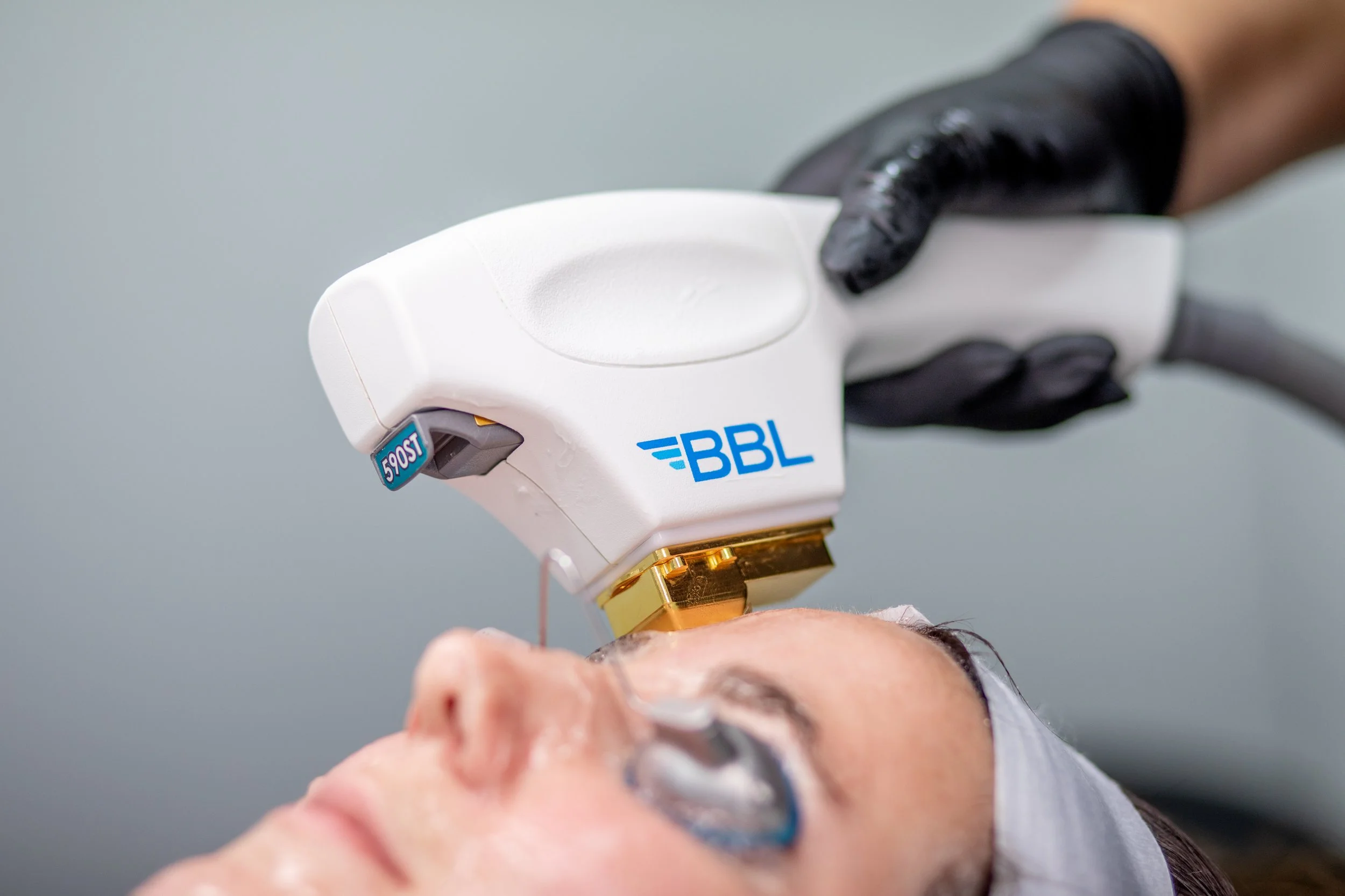 Skin-Therapy BBL and Moxi - Tuesday Skin Studio, Northland — Tuesday ...