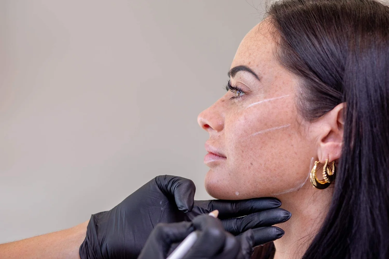 Cosmetic Skin Injector