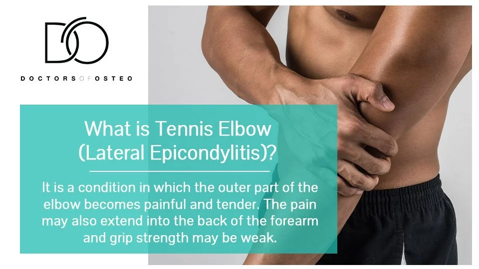 Osteo for Lateral Epicondylitis | Outer Elbow Pain