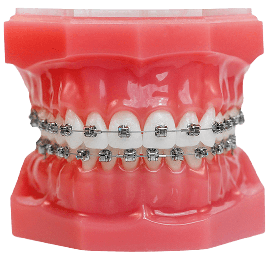 Good Day Orthodontics | Orthodontist Santa Maria CA