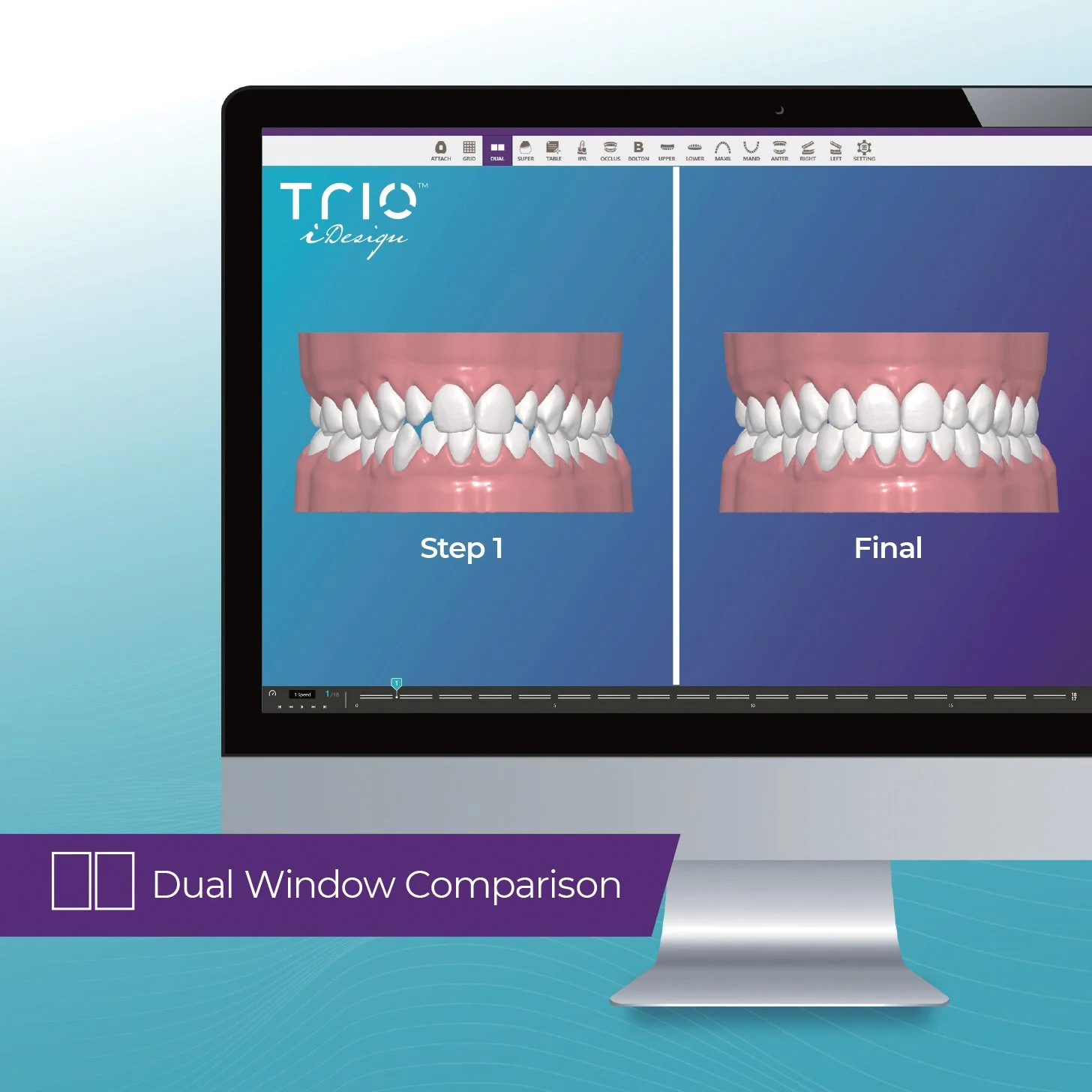 General 4 — TrioClear