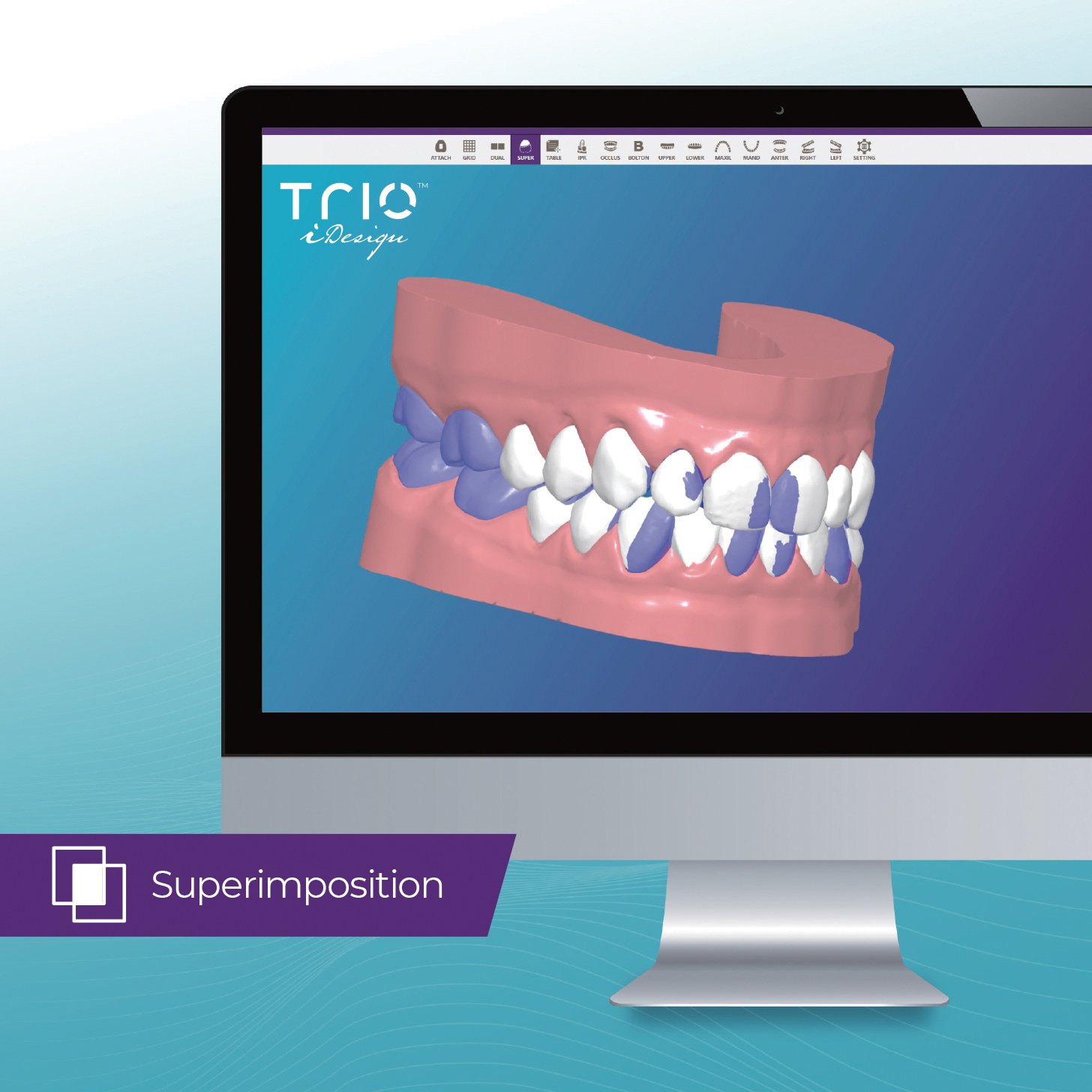 General 4 — TrioClear