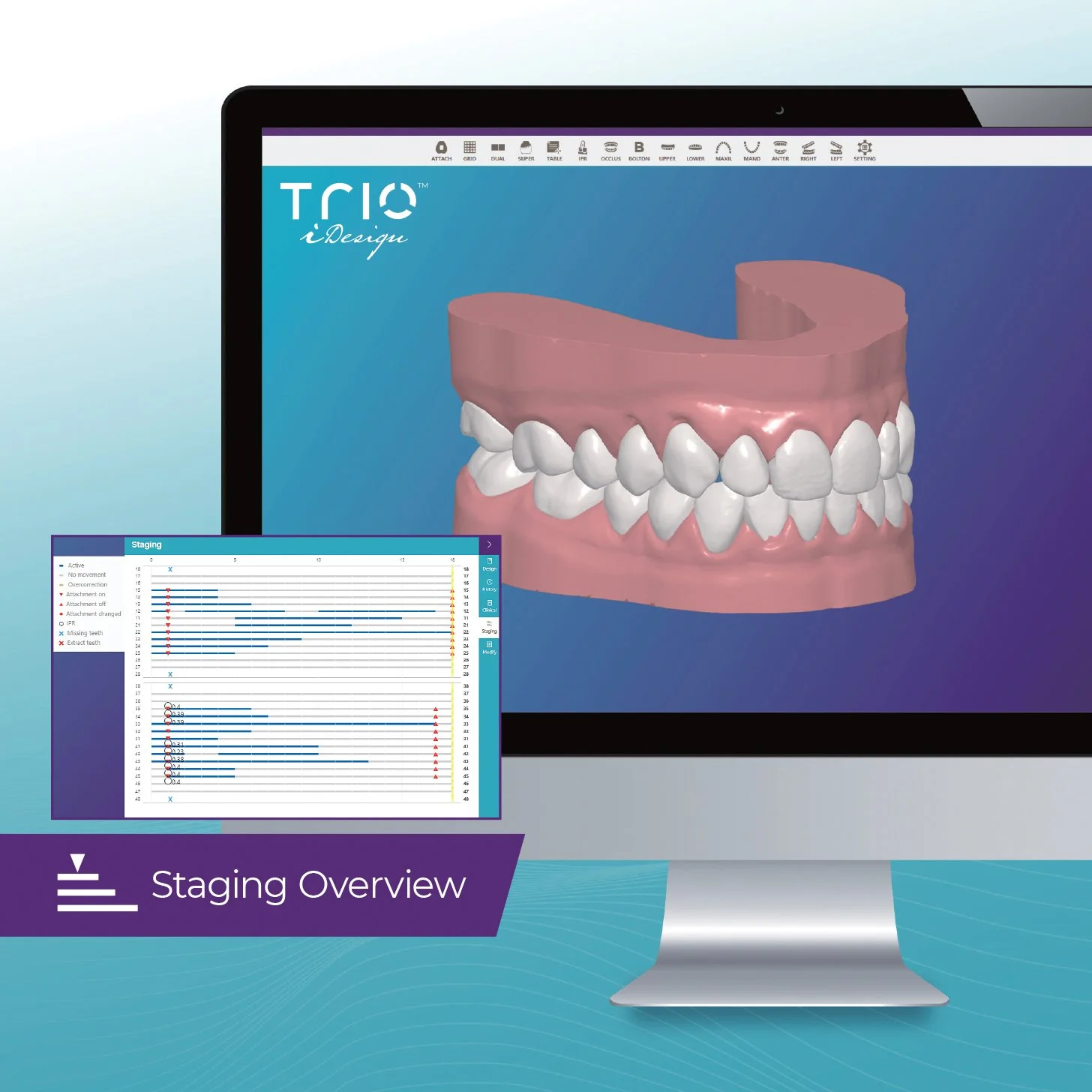 General 4 — TrioClear