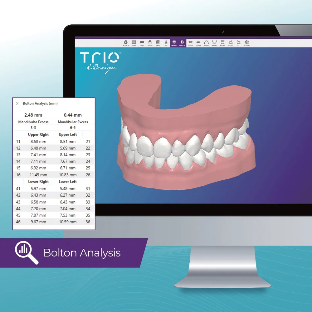 General 4 — TrioClear