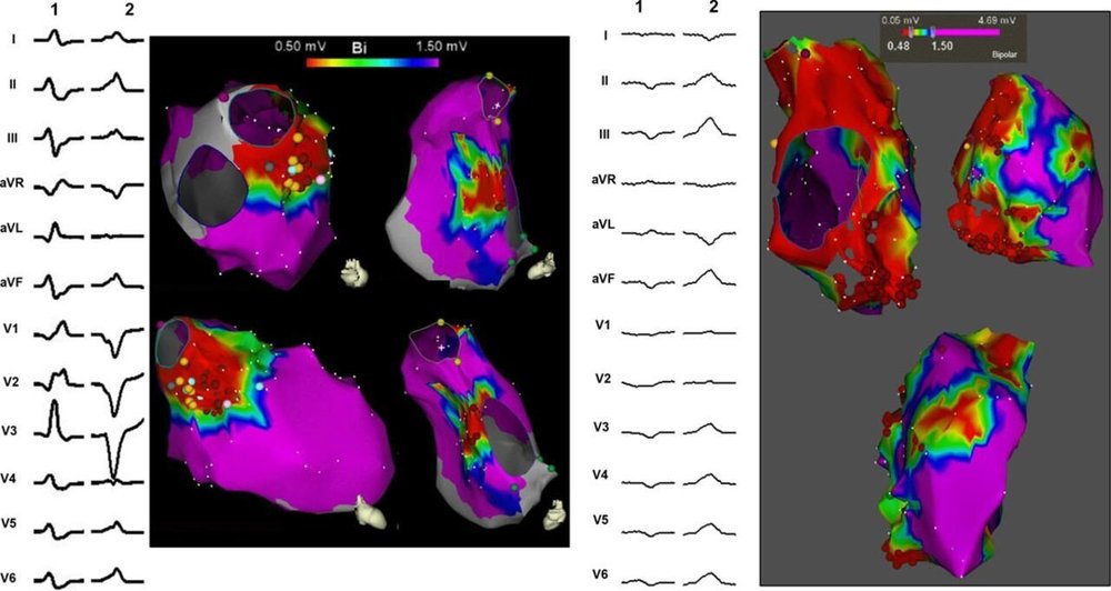 Clinical Cardiac Electrophysiology