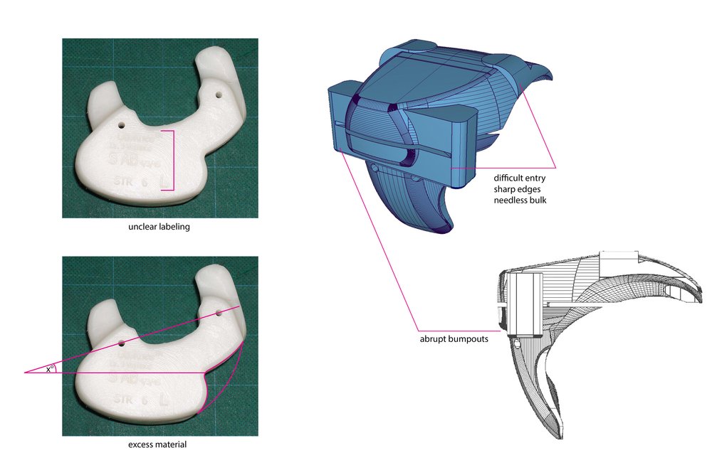 Tibial Alignment — Humanfactors Design Works