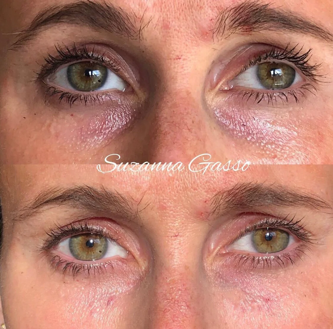 Before & After — SG AESTHETICS