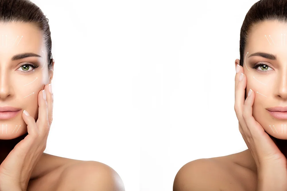 Facial Harmonization — SG AESTHETICS