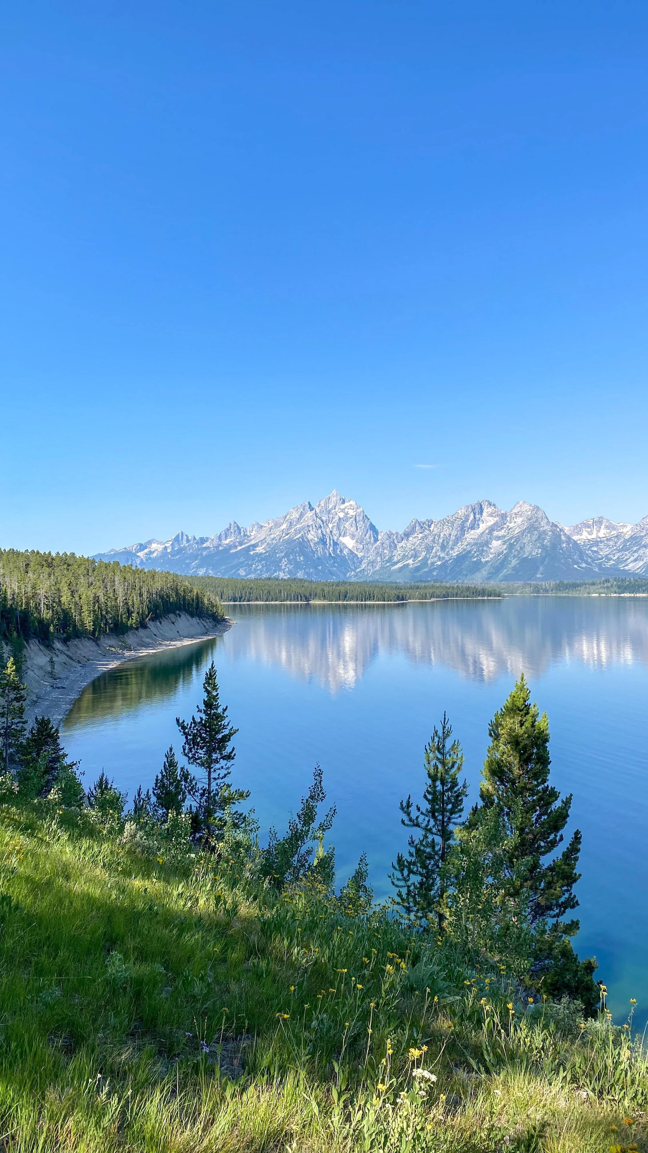 Lip Filler Progress | Before & Afters — That Boujee Bohemian | Travel & Lifestyle Blog