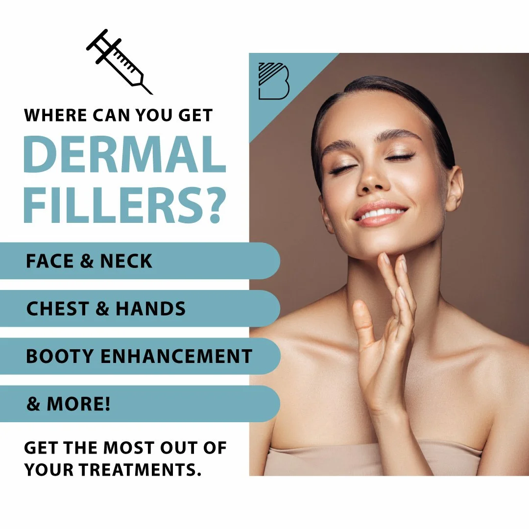 What are Dermal Fillers?