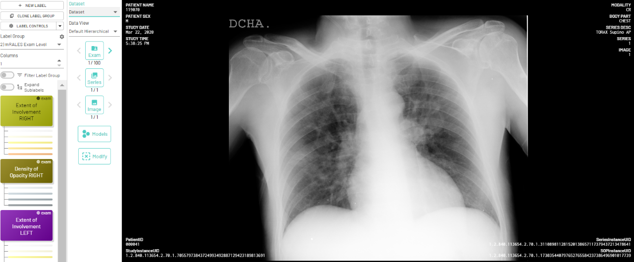 MIDRC at RSNA annual meeting 2022 — MIDRC