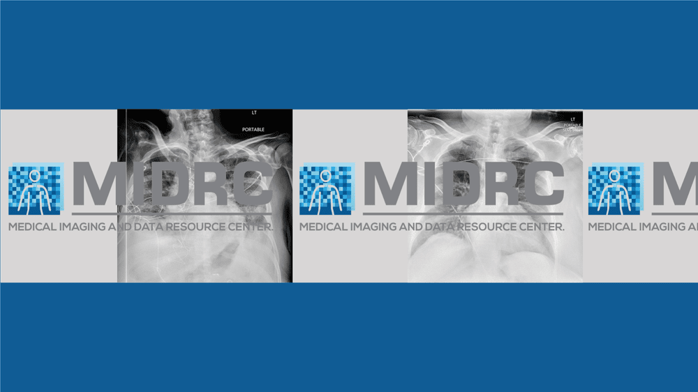 More about MIDRC — MIDRC