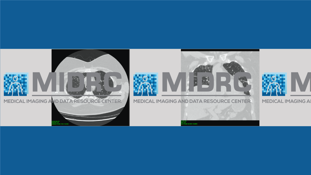 More about MIDRC — MIDRC