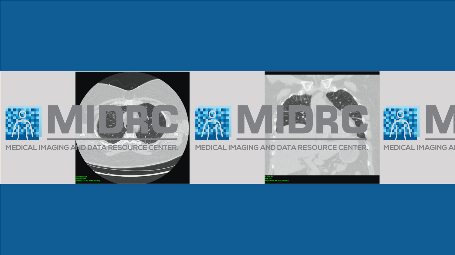 More about MIDRC — MIDRC