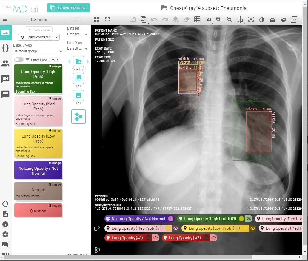 TDP 4: Collaborative development of common user access portal, ... — MIDRC
