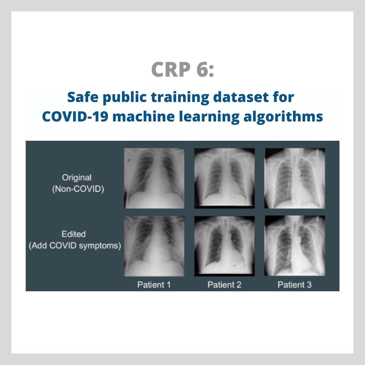 MIDRC Collaborative Research Projects — MIDRC