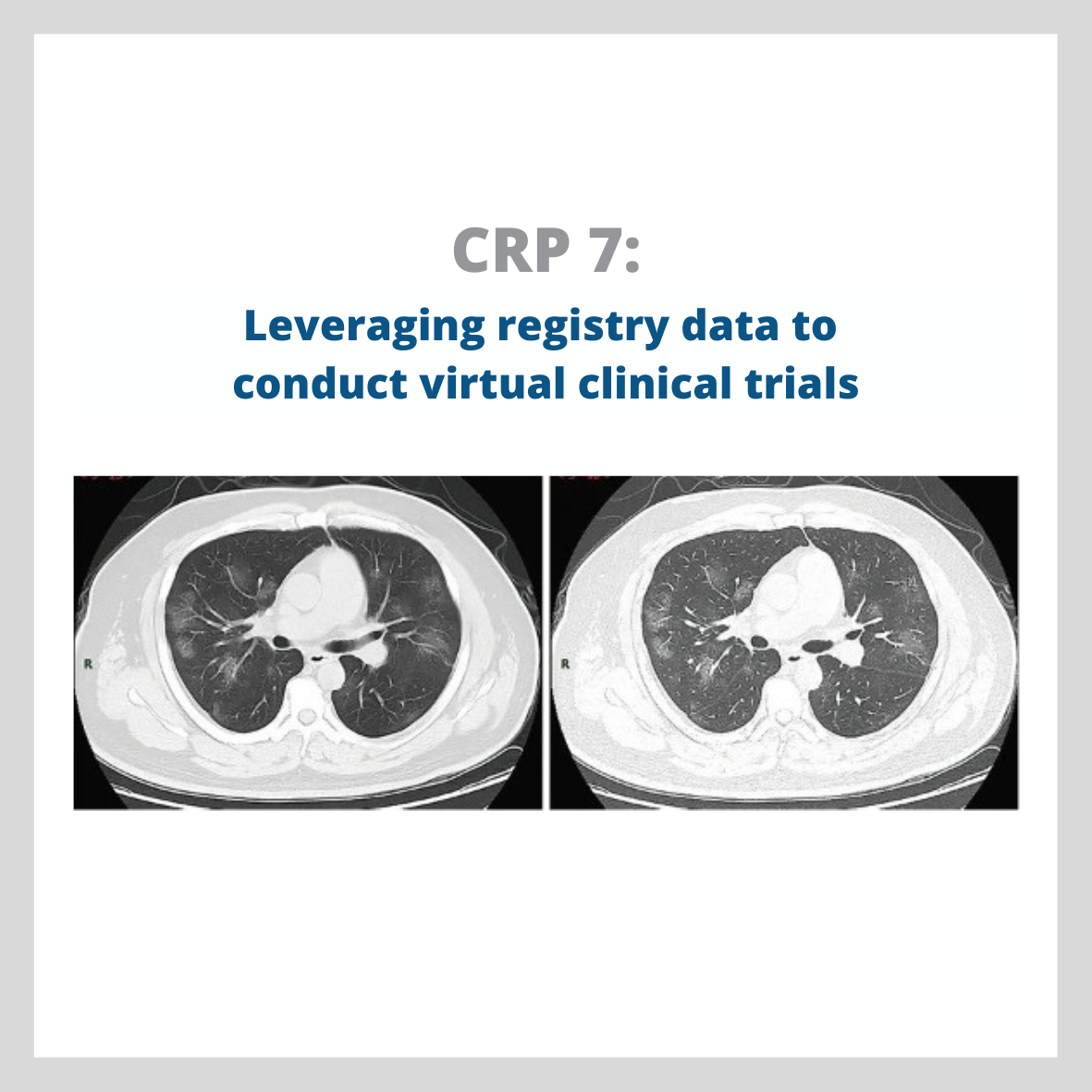 MIDRC Collaborative Research Projects — MIDRC