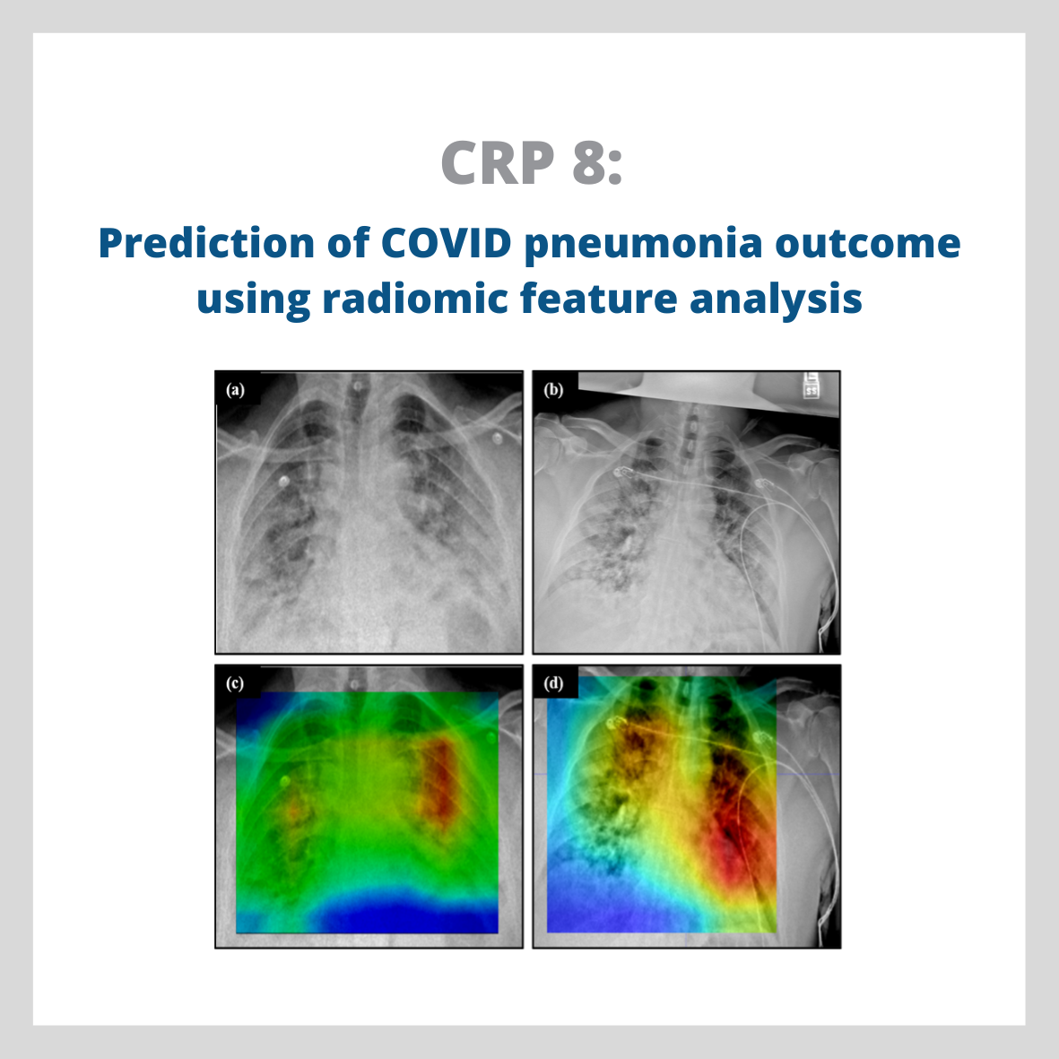 MIDRC Collaborative Research Projects — MIDRC