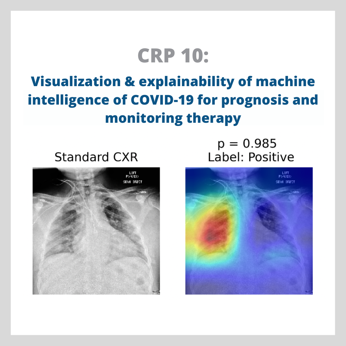MIDRC Collaborative Research Projects — MIDRC