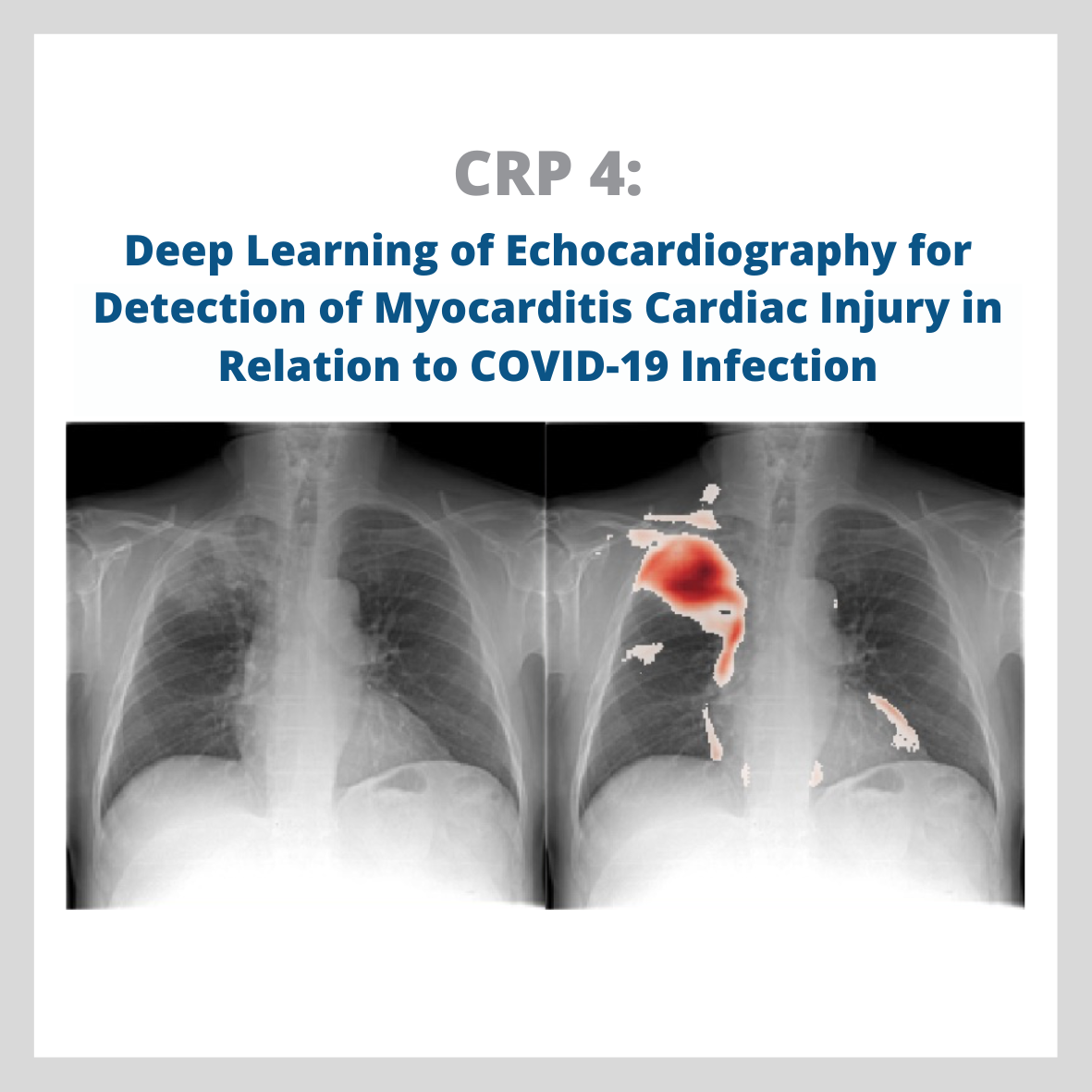 MIDRC Collaborative Research Projects — MIDRC