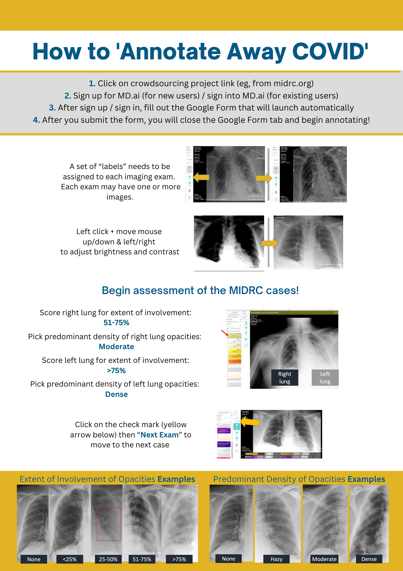 Annotate Away COVID event — MIDRC