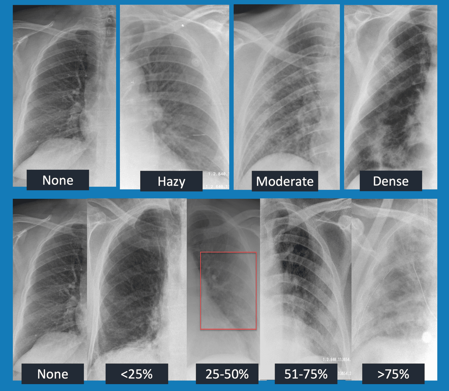 Annotations — MIDRC