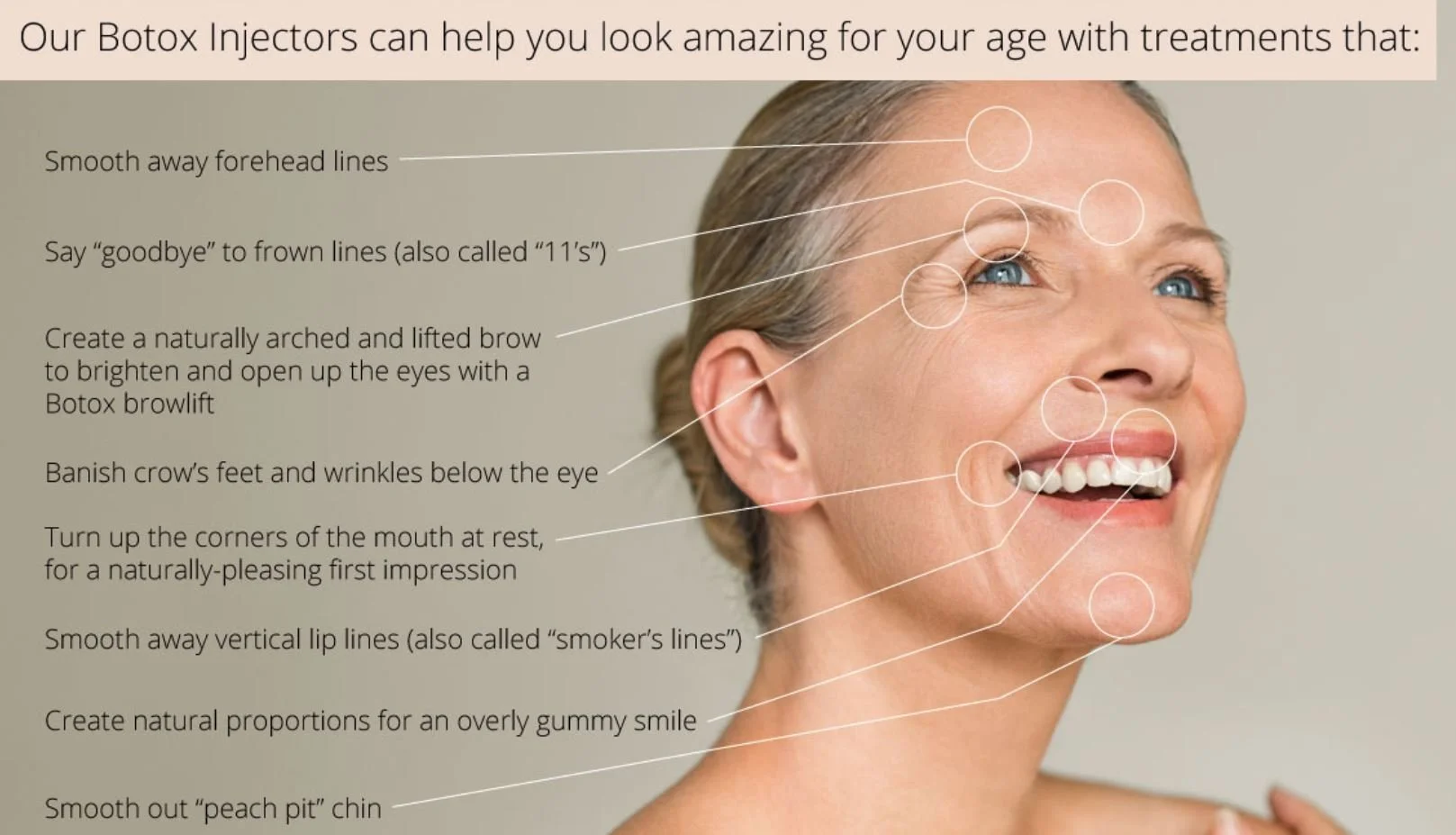 Botox — Young Again Aesthetics