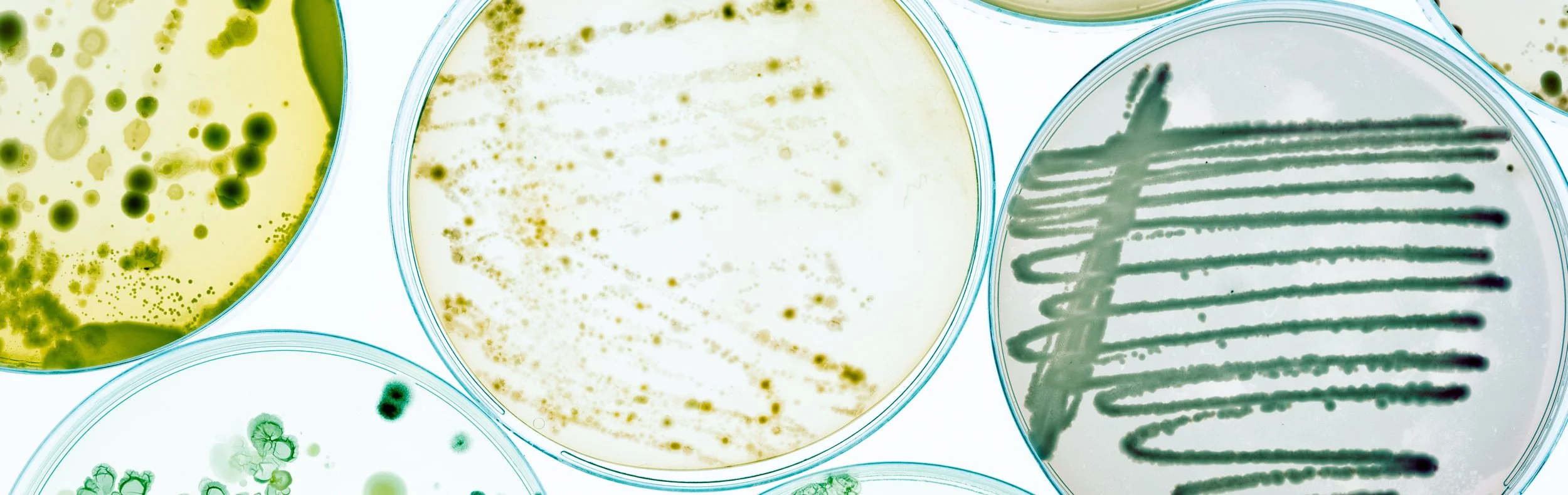 Precision Fermentation - Fermenting the future — ECBF