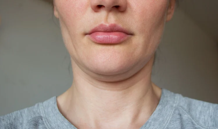 3 Common Causes of Saggy Neck and Jowls — Brow To Toe