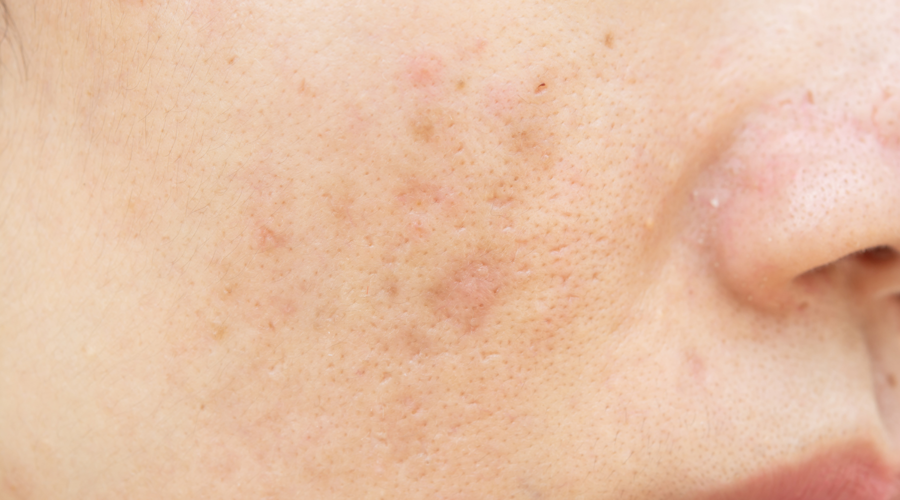 The Hidden Impact of Smoking on Your Skin — Brow To Toe