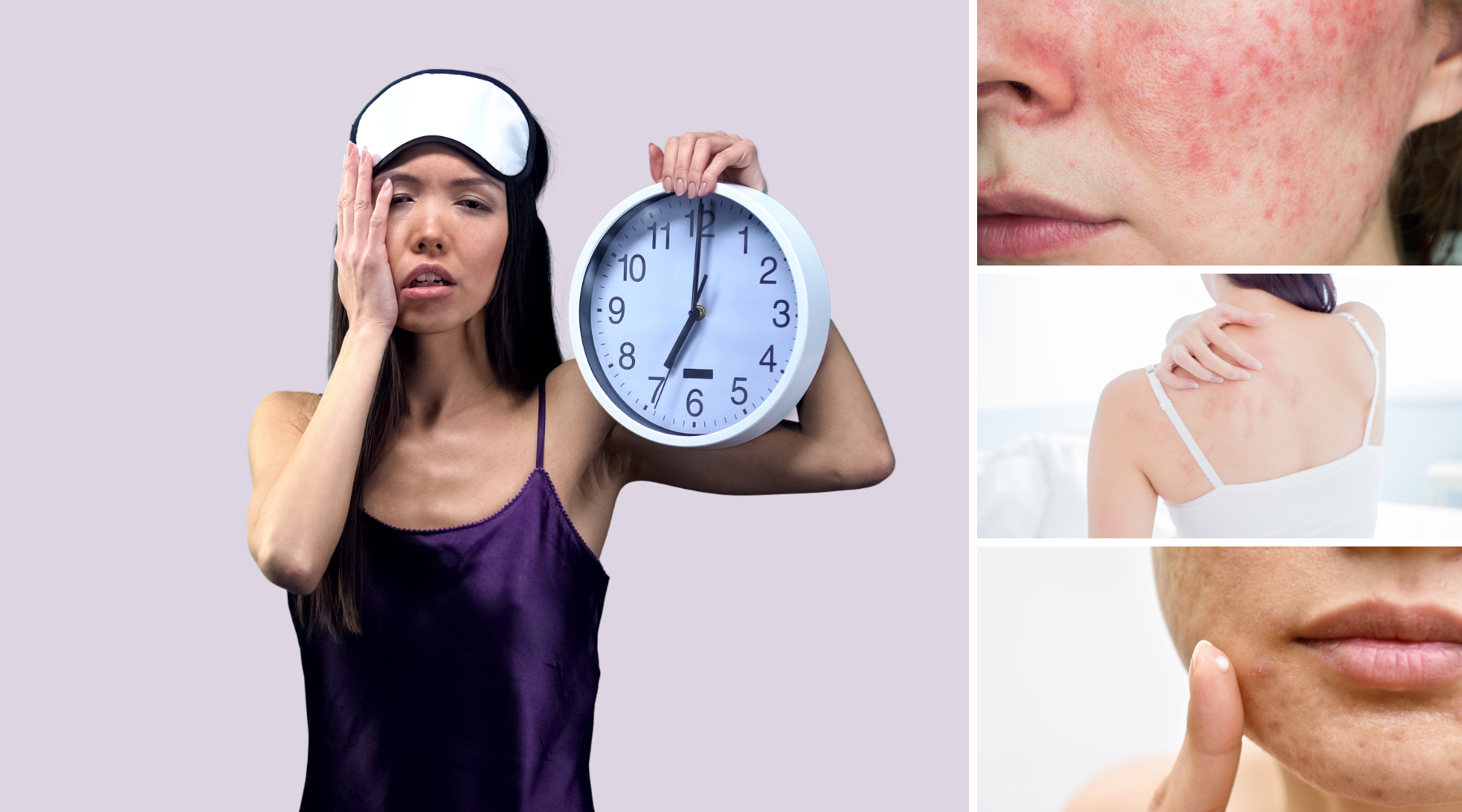 The Surprising Connection Between Sleep and Common Skin Conditions ...