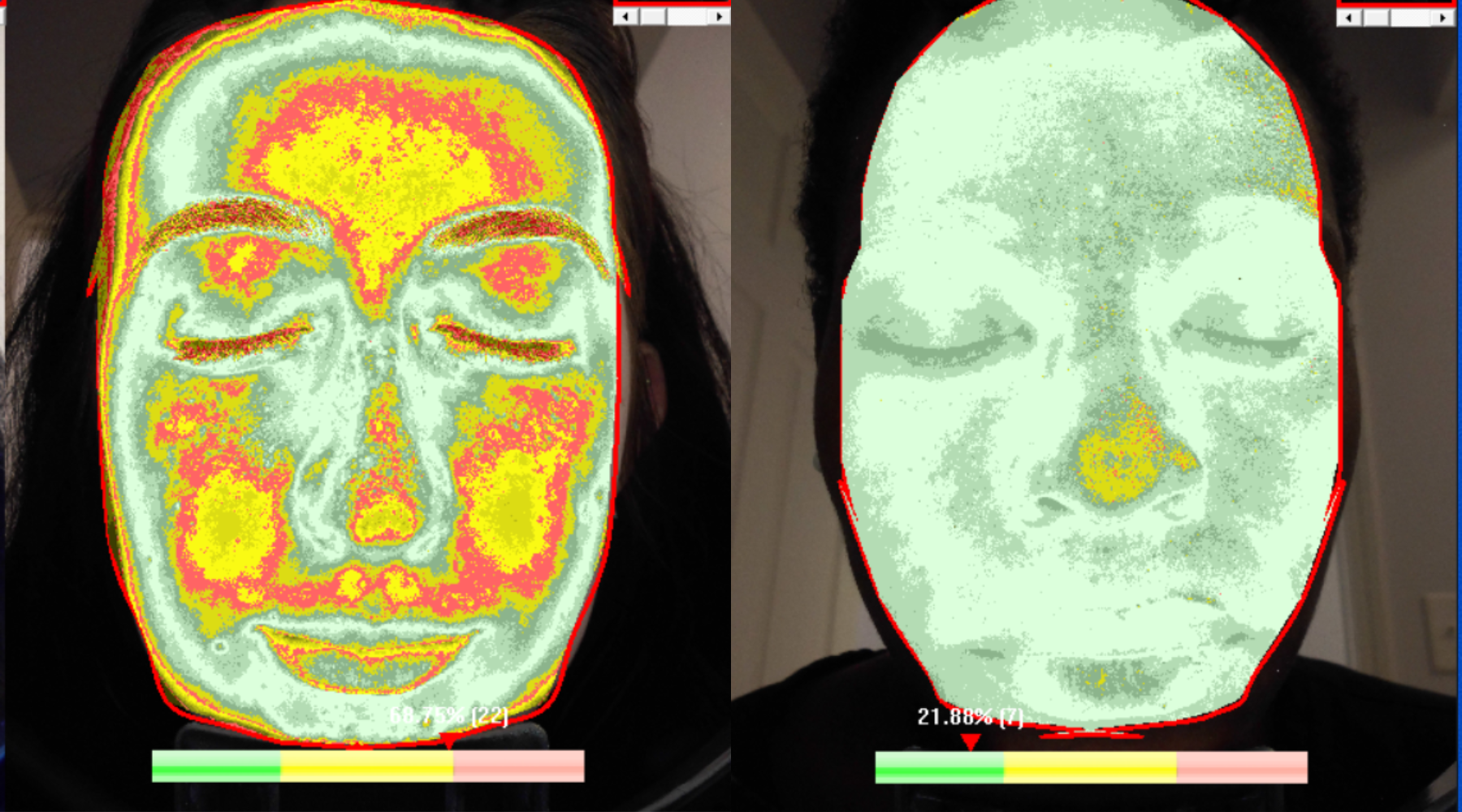 Cellular Turnover VS Exfoliation: Which is better? — Brow To Toe